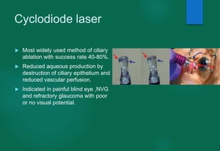Glaucoma management paradigms | PPTX