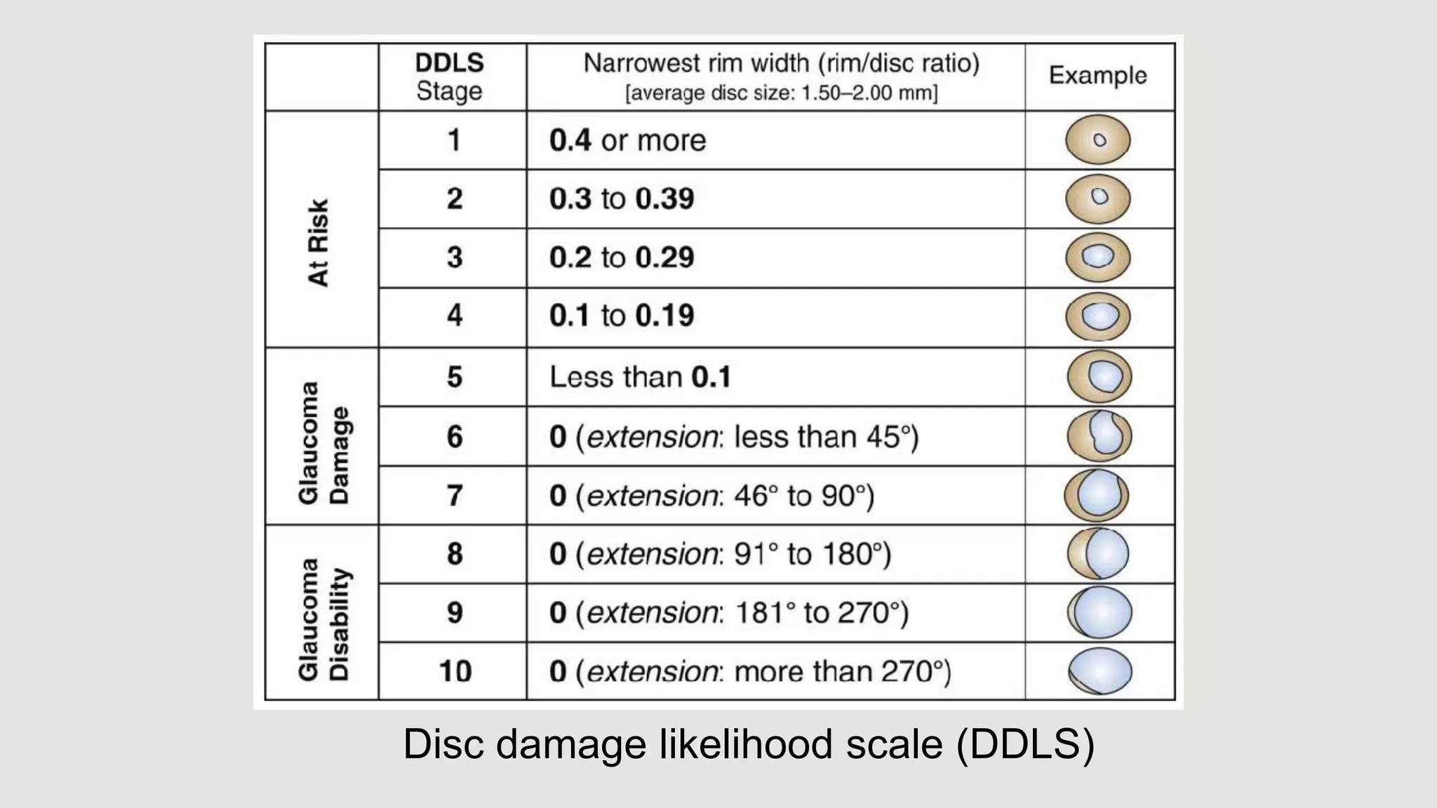 GLAUCOMA MEDICATION.pptx