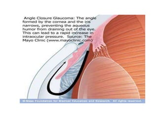Glaucoma new.pptx