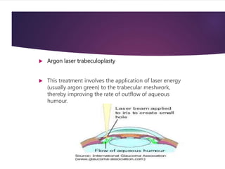 Glaucoma new.pptx