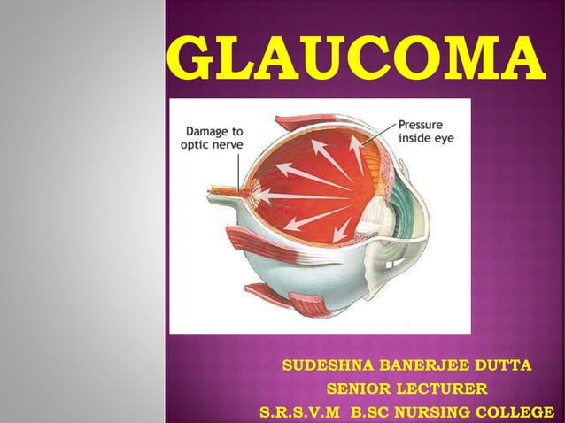 Glaucoma | PPT