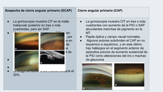 Glaucoma (Oftalmologia).pdf