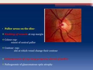Glaucoma optic disc changes | PPTX