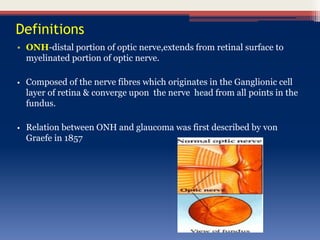 Glaucoma optic disc changes | PPTX