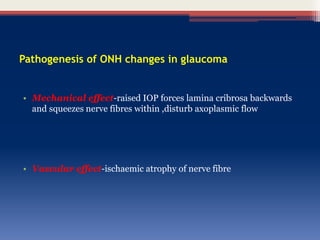 Glaucoma optic disc changes | PPTX