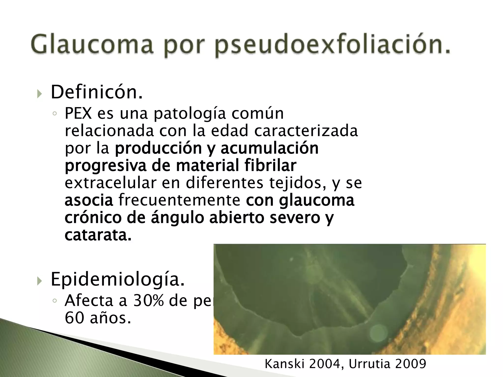 Glaucoma por pseudoexfoliación y neovascular | PPTX