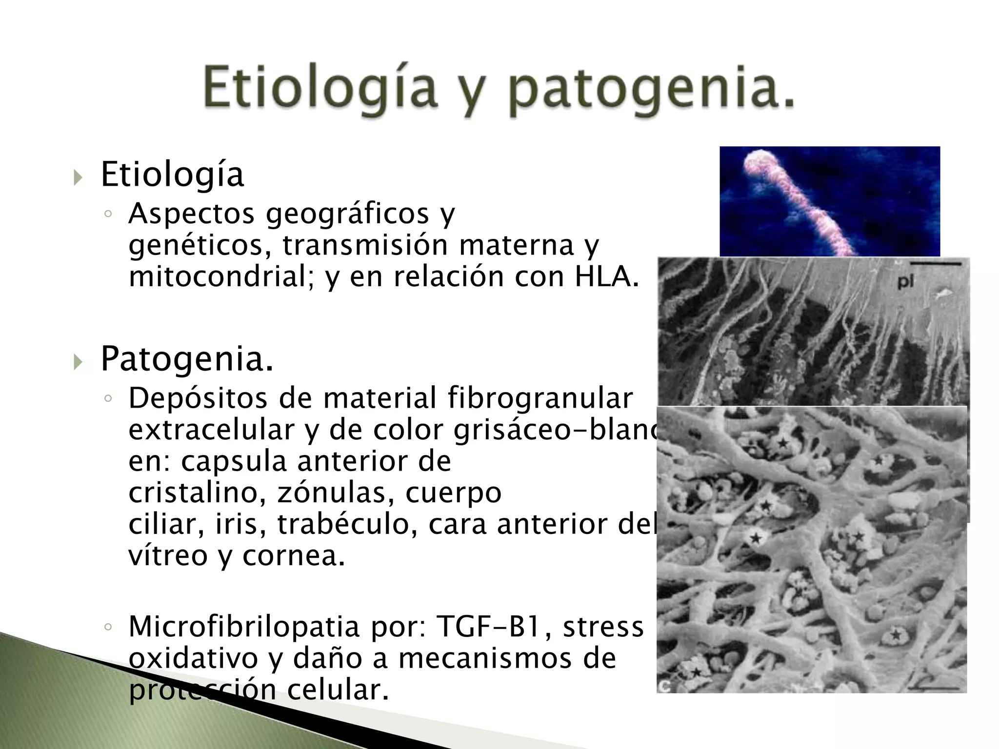 Glaucoma por pseudoexfoliación y neovascular | PPTX