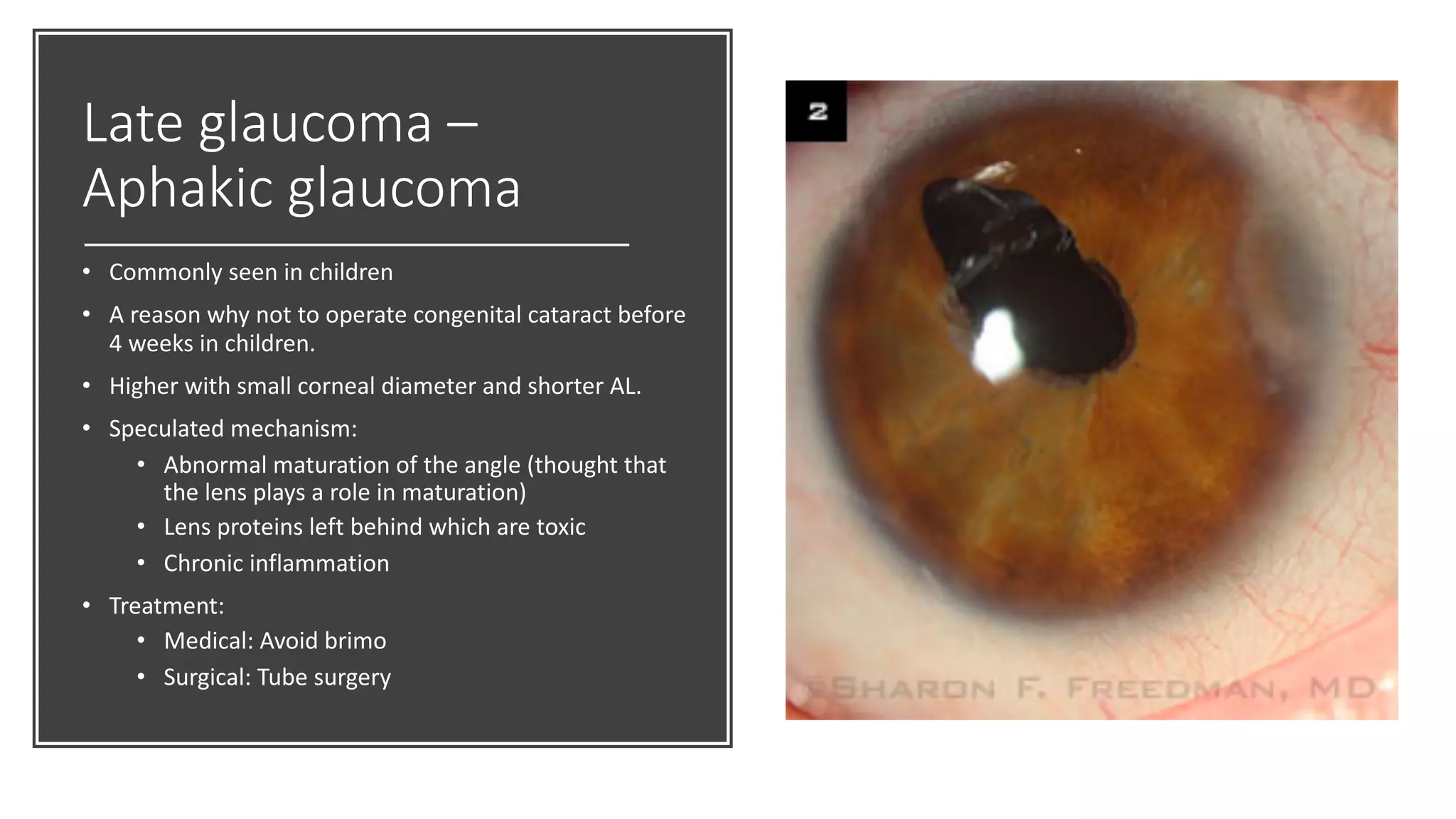 Glaucoma post cataract surgery | PDF