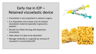 Glaucoma post cataract surgery | PDF