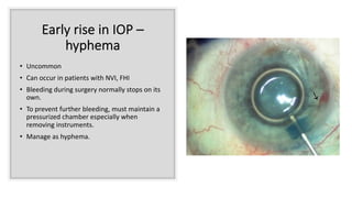 Glaucoma post cataract surgery .pdf