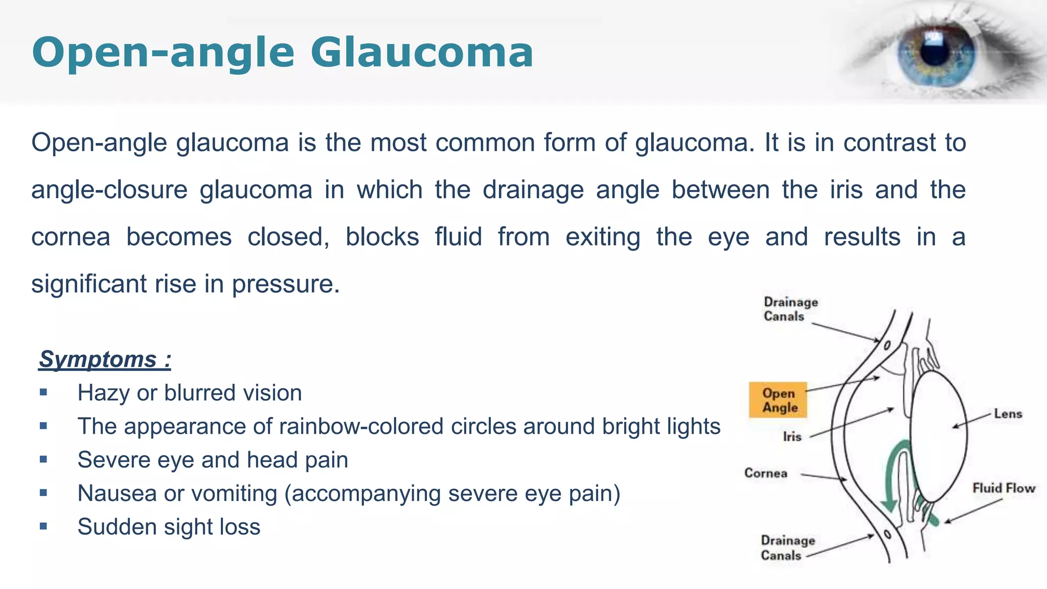 Glaucoma ppt. | PPTX