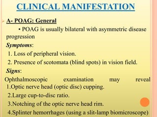 GLAUCOMA PPT | PPSX | Eye and Vision Conditions | Diseases and Conditions