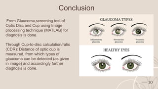 Glaucoma Screening Test by Segmentation of Optical Disc & Cup Using ...