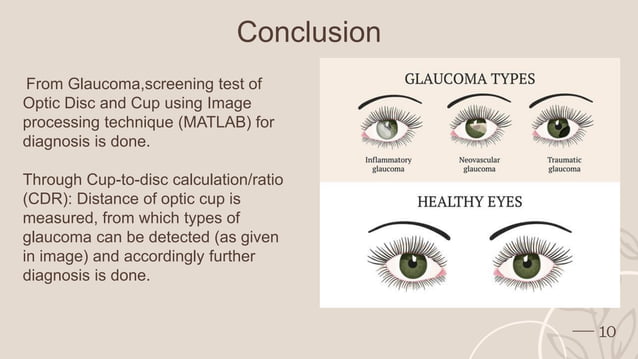 Glaucoma Screening Test by Segmentation of Optical Disc & Cup Using ...