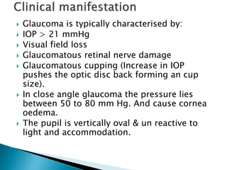 Glaucoma ppt by ved | PPTX