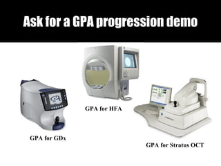 Glaucoma progression show loop mcaf rev 2 | PPT