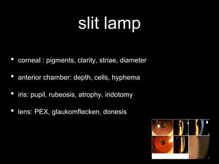 Glaucoma review | PPTX