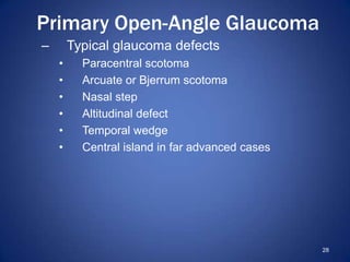 Glaucoma Review by Dr. Allen | PPTX