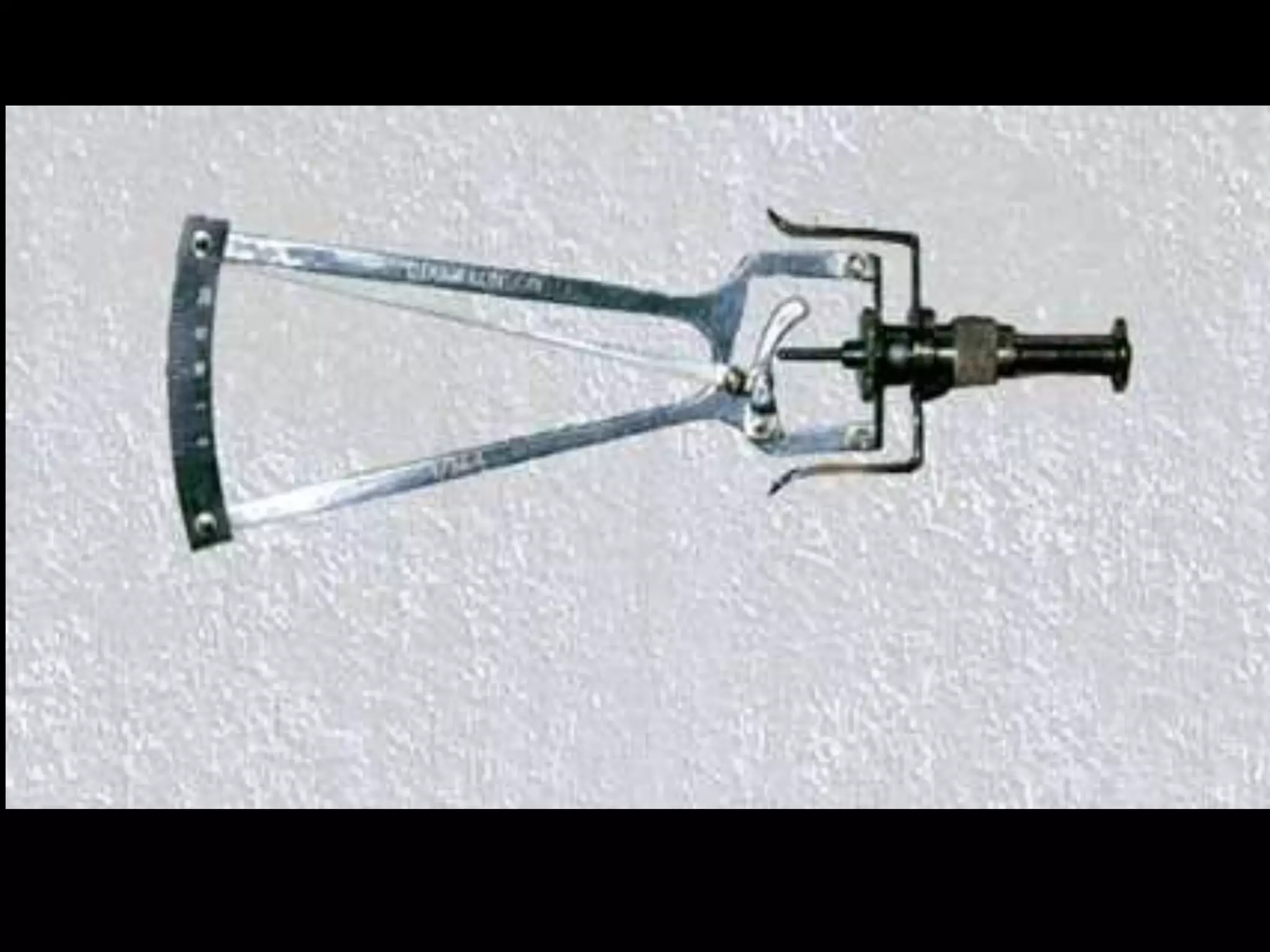 Glaucoma revision | PPT