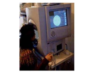 Glaucoma revision | PPT