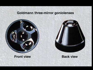 Glaucoma revision | PPT