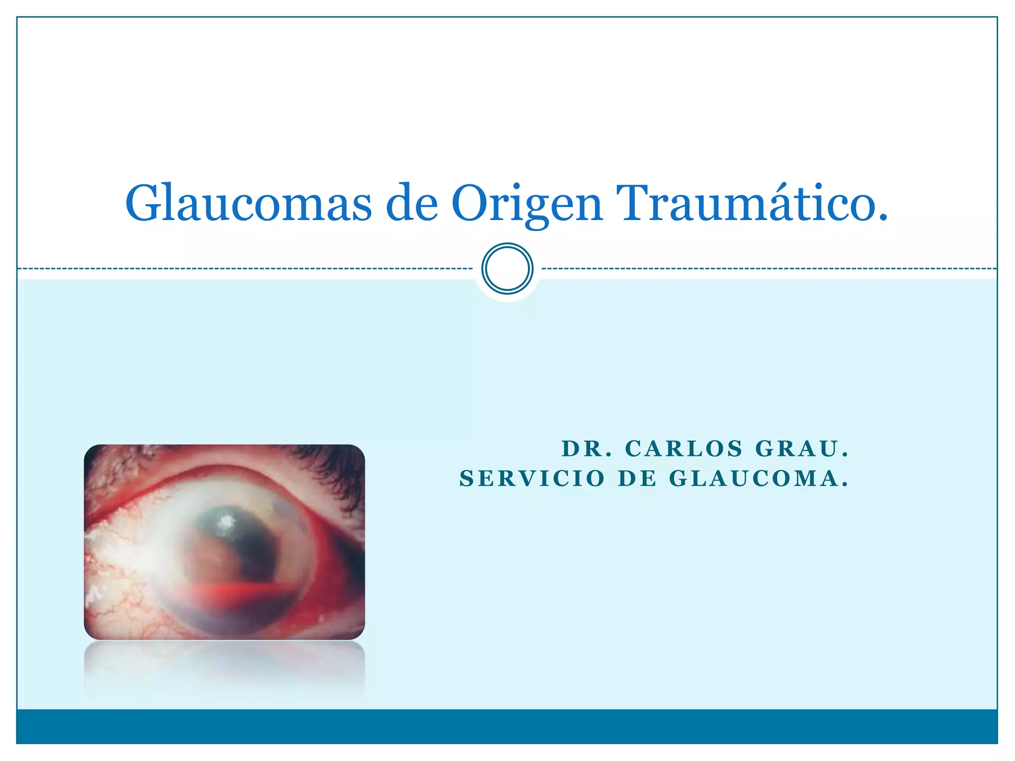 Glaucomas de origen traumatico | PPTX