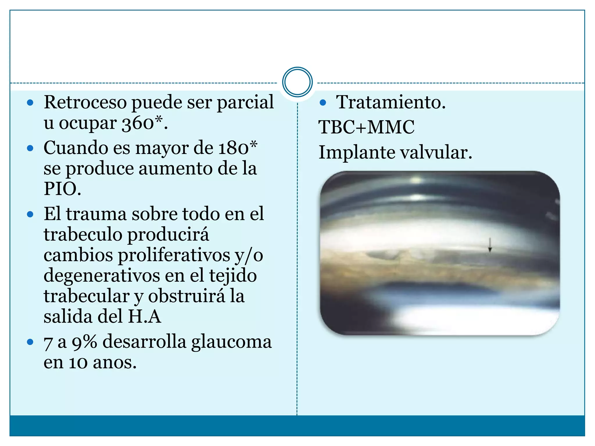 Glaucomas de origen traumatico | PPTX