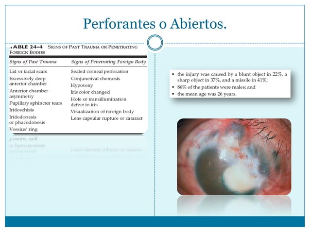 Glaucomas de origen traumatico | PPTX