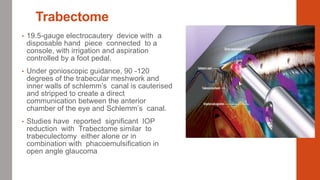 ADVANCES IN GLAUCOMA SURGERY - MIGS | PPT