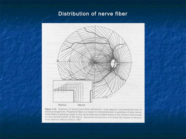 Glaucoma & target iop | PPT