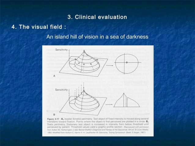 Glaucoma & target iop | PPT