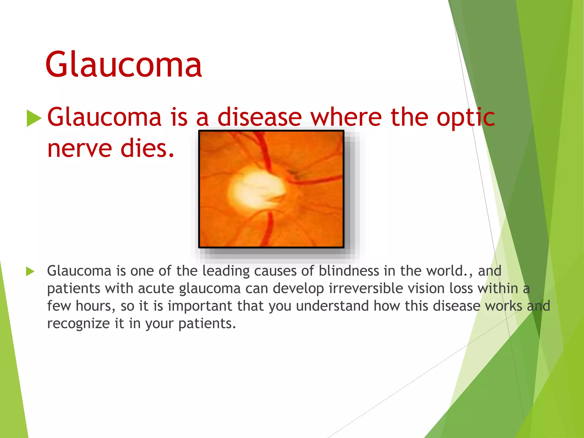 Glaucoma,topic 4 presentation | PPT