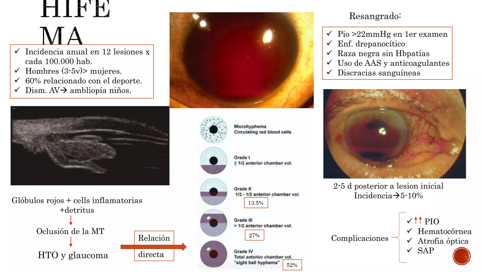 Glaucoma traumático | PPTX