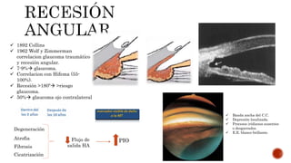 Glaucoma traumático | PPTX