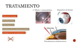 Glaucoma traumático | PPTX