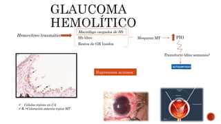 Glaucoma traumático | PPTX