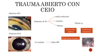 Glaucoma traumático | PPTX