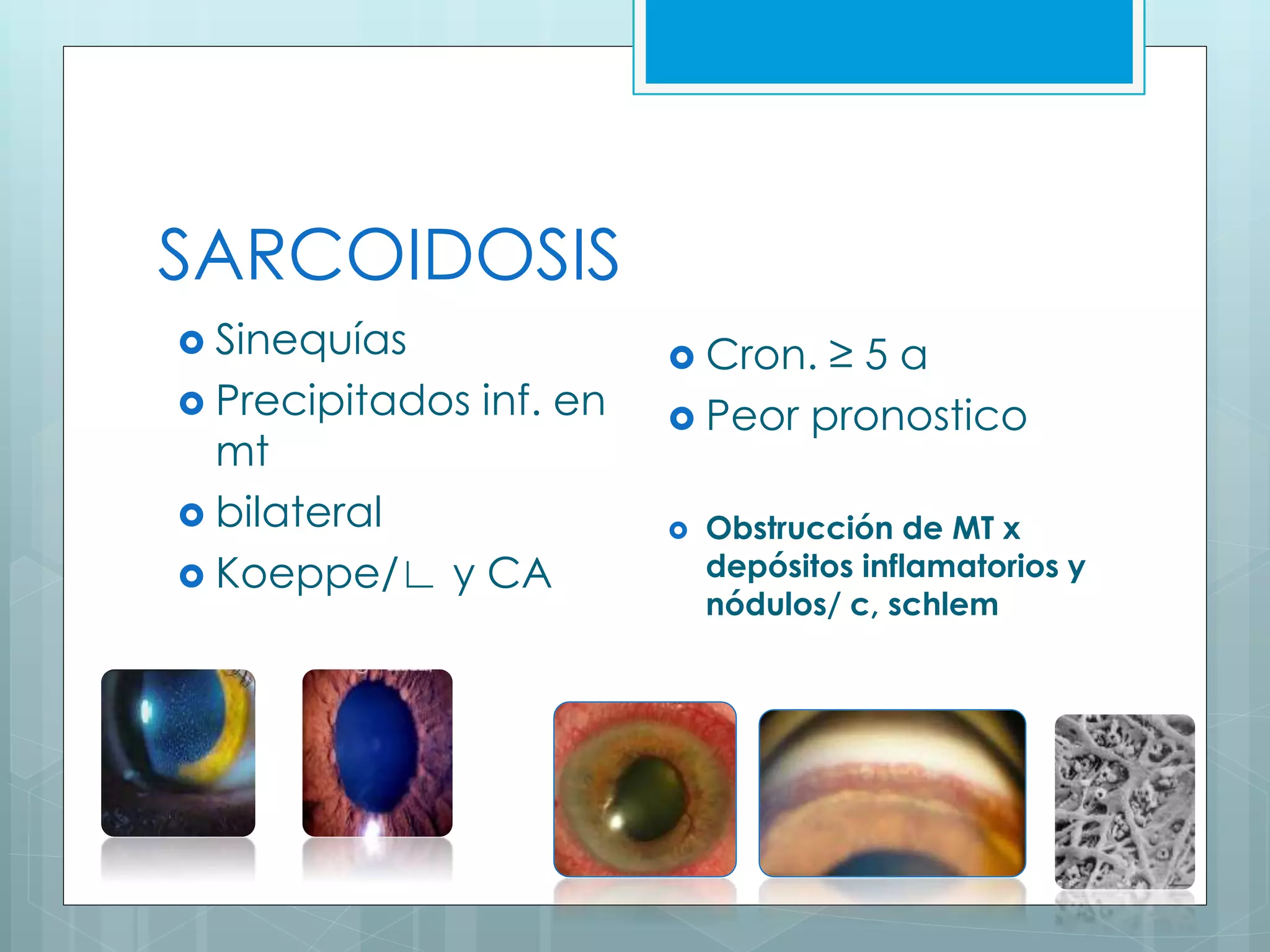 Glaucoma traumatico e inflamatorio ppt | PPTX