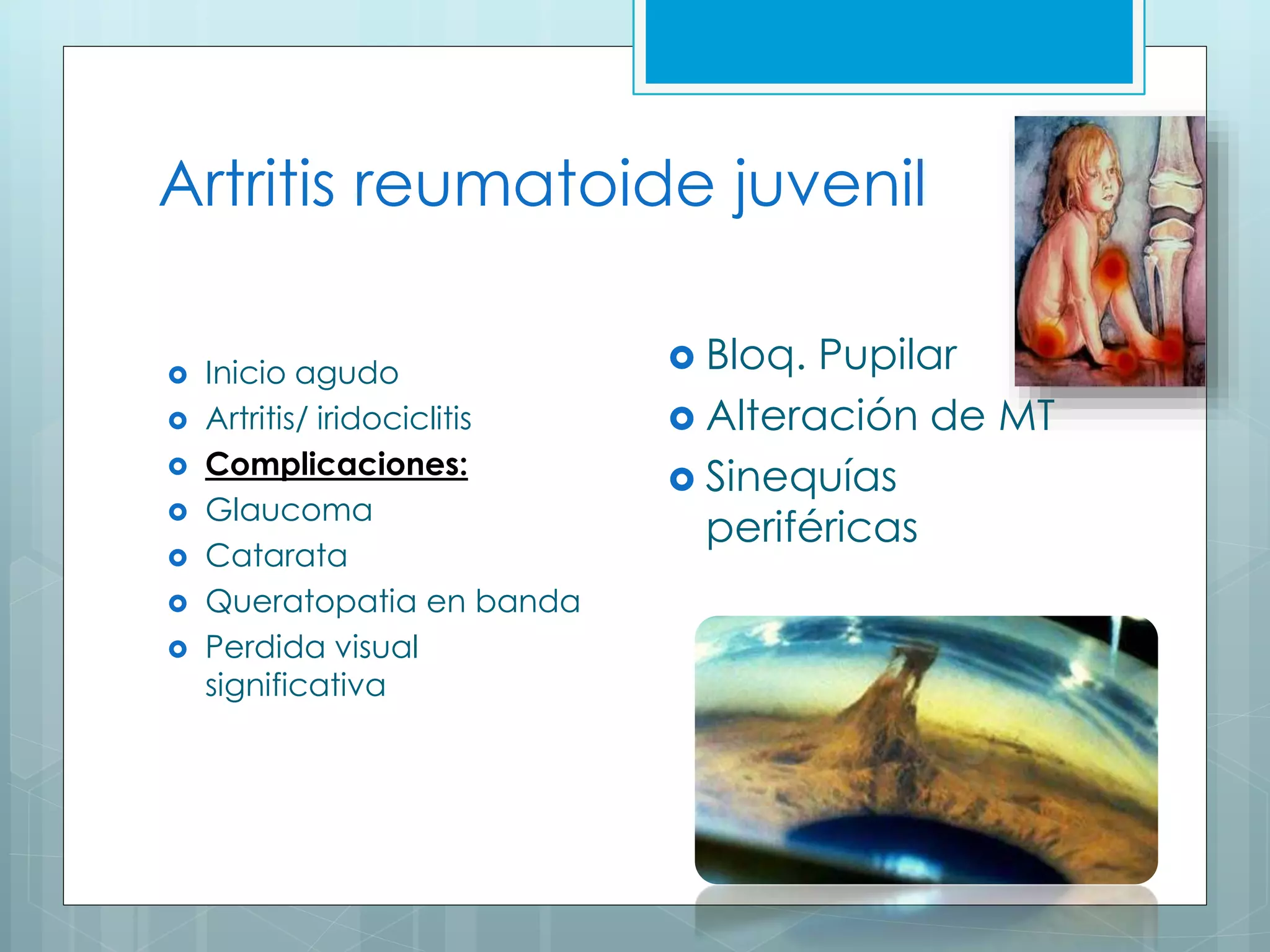 Glaucoma traumatico e inflamatorio ppt | PPTX