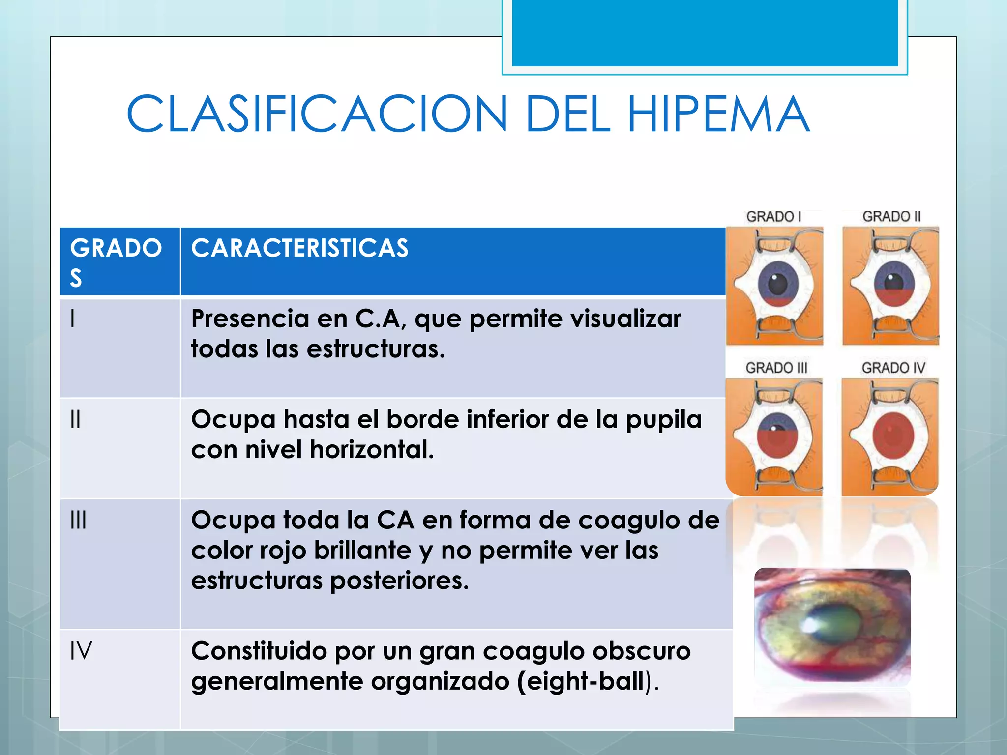 Glaucoma traumatico e inflamatorio ppt | PPT | Descarga Gratuita