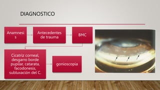 Glaucoma traumático, inflamatorio y asociado a esteroides jean (1).pptx
