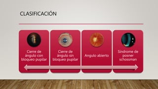 Glaucoma traumático, inflamatorio y asociado a esteroides jean (1).pptx