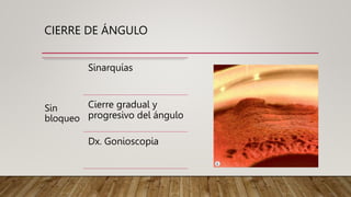 Glaucoma traumático, inflamatorio y asociado a esteroides jean (1).pptx