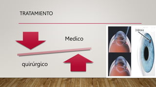 Glaucoma traumático, inflamatorio y asociado a esteroides jean (1).pptx