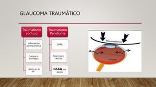 Glaucoma traumático, inflamatorio y asociado a esteroides jean (1).pptx