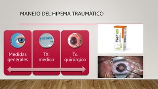 Glaucoma traumático, inflamatorio y asociado a esteroides jean (1).pptx