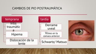 Glaucoma traumático, inflamatorio y asociado a esteroides jean (1).pptx