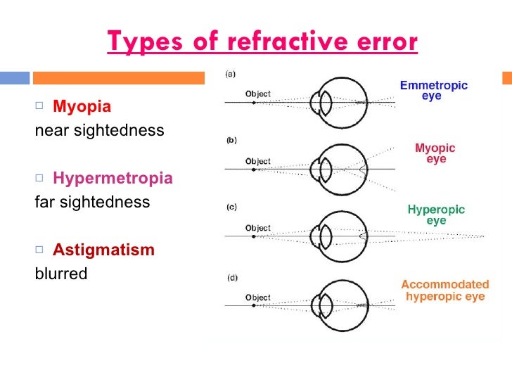 Common Ocular Diseases (World Glaucoma Day)