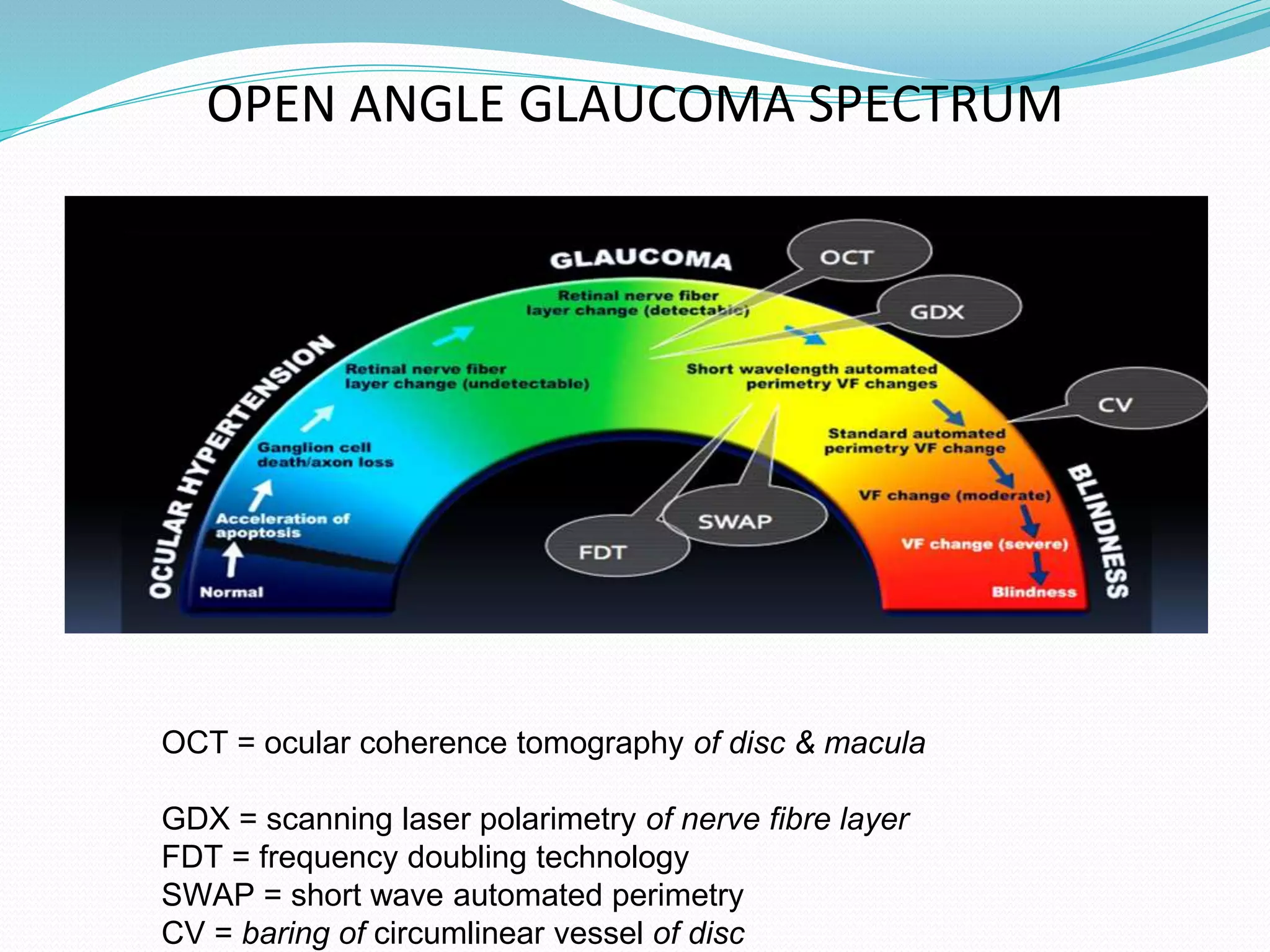 GLAUCOMA | PPT