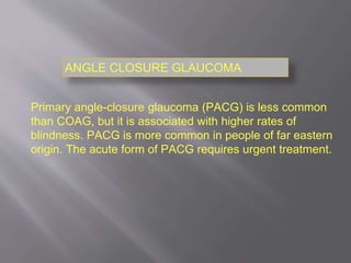 GLAUCOMA | PPT